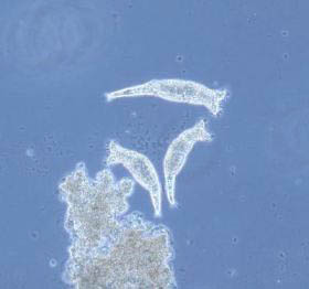 Microscopic ‘water bear’ is first animal to survive vacuum of space ...